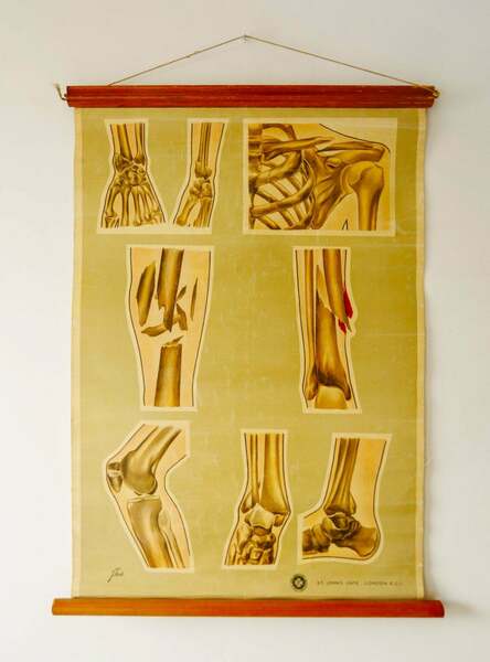 Original Anatomical Vintage British Educational School Wall Chart Bone ...