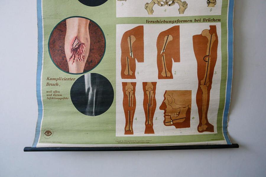 Original Anatomical Vintage German Educational School Wall Chart Bone ...