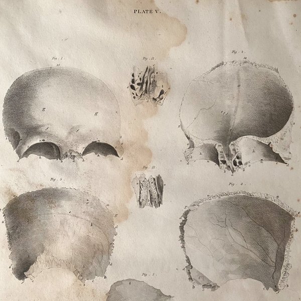 Wall Hangings Skull Fragments Lizars 1824 'System of Anatomical Plates ...